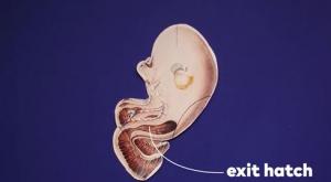 Could You Eat So Much That Your Stomach Explodes?